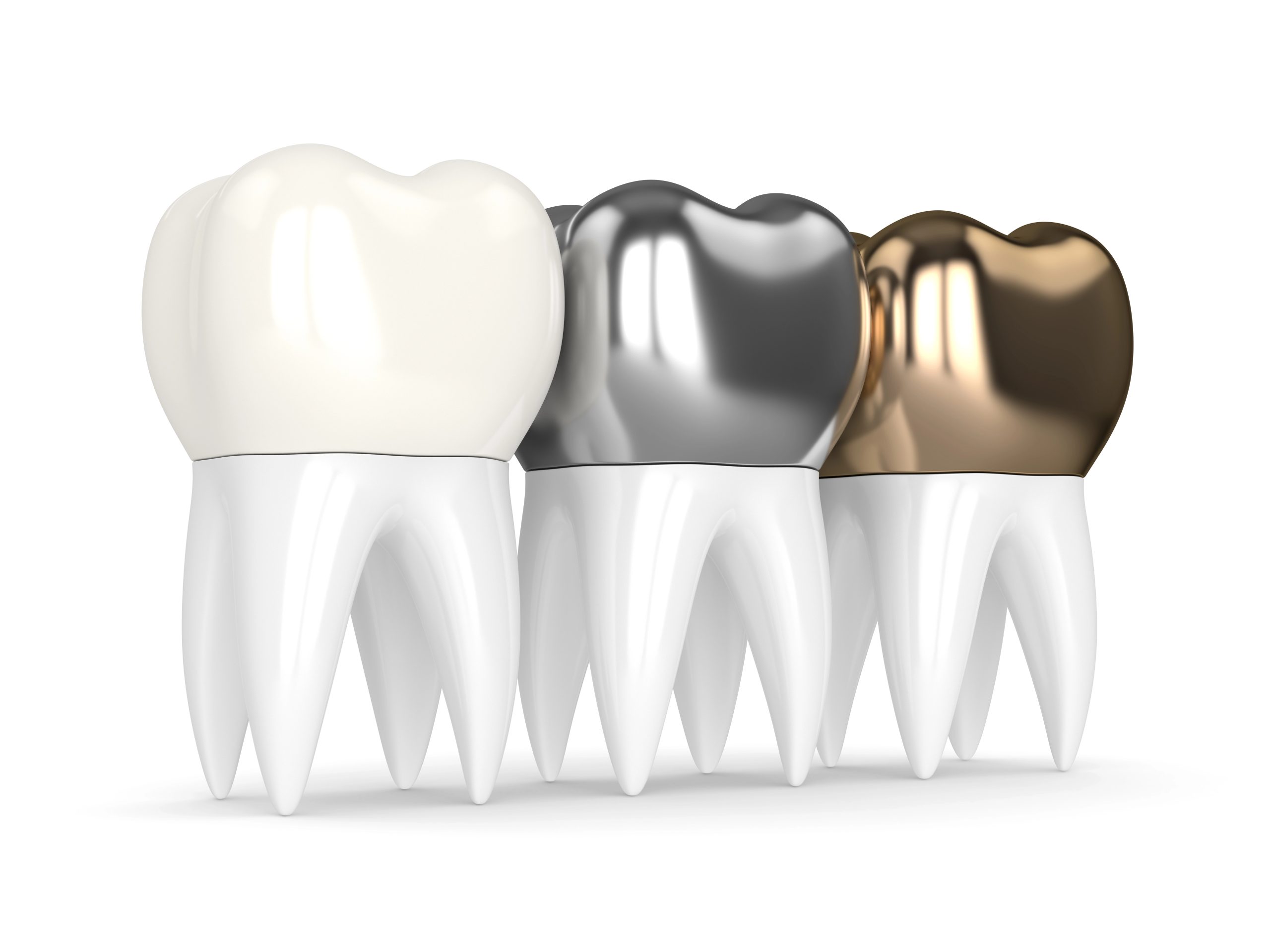Dental Crowns Without Metal: Natural-Looking Options for a Brighter ...